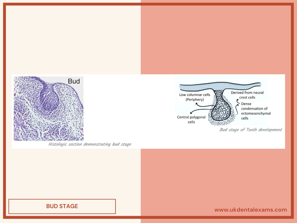 Tooth Development and Histology: Stages of Odontogenesis